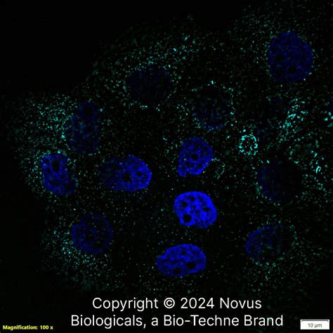Cd63 Antibody H5c6 Bsa Free Nbp2 42225 By Novus Part Of Bio Techne