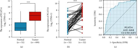 Lncrna Pcat14 Is A Diagnostic Marker For Prostate Cancer And Is Associated With Immune Cell