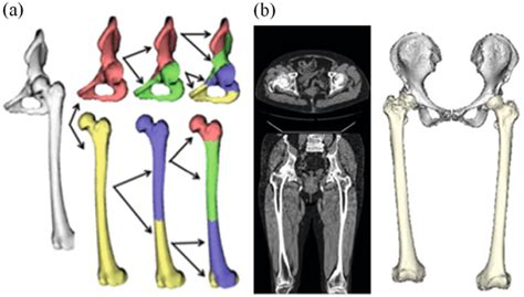Bone Computational Anatomy Based On Whole Body Imaging Basic