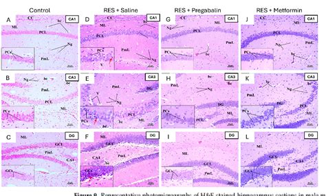 Figure 9 From The Antinociceptive Effects And Sex Specific Neurotransmitter Modulation Of