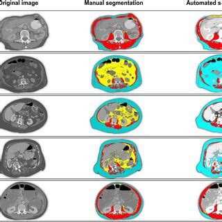 Manual And Automated Segmentation Of Body Composition From CT Produces Download Scientific
