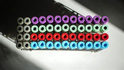 Hyperthyroidism Tsh Levels Meaning Signs And More