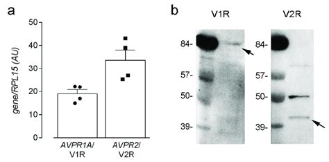 Expression Of Vasopressin Receptors In Microvascular Endothelial Cells Download Scientific