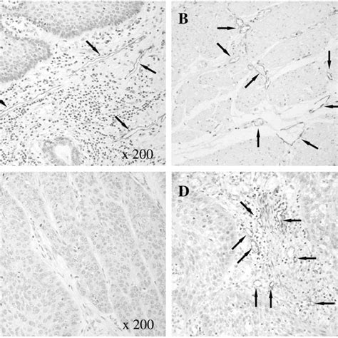 Podoplanin Positive Lymphatic Vessels A B Arrow At The Submucosal Download Scientific