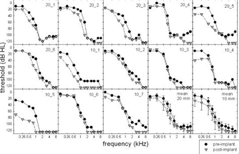 Individual And Mean Audiometric Thresholds In Db Hl Obtained Download Scientific Diagram