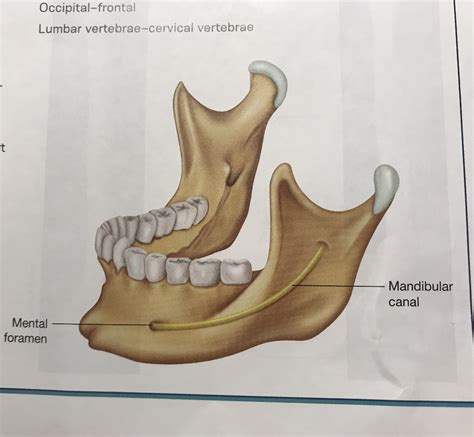 Solved Consider The Mandibular Canal Pictured Here It Is