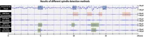 Visual And Automatic Sleep Spindle Detections In A 20 S N2 Sleep Download Scientific Diagram