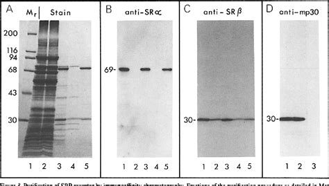 Figure 3 From The Signal Recognition Particle Receptor Is A Complex That Contains Two Distinct