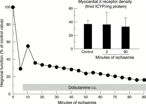 Hibernating Myocardium Heart