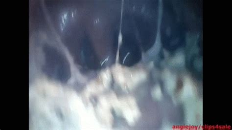 Endoscopy While Crushing Food Wmv Angiejoy Clips4sale