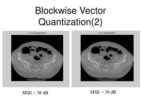 ppt a region of interest approach for medical image compression powerpoint presentation id