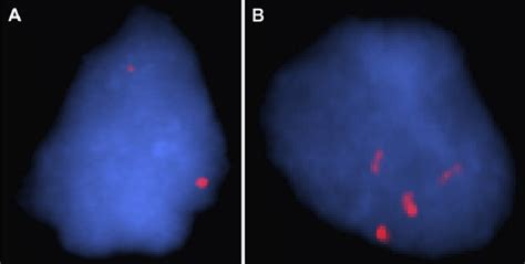 Interphase Fluorescence In Situ Hybridization Fish Analysis On