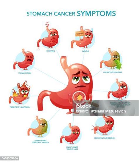 증상 위암 인포그래픽 얼굴과 다른 감정을 가진 귀여운 만화 위 캐릭터 교육용 해부학적 벡터 그림입니다 건강관리와 의술에 대한 스톡 벡터 아트 및 기타 이미지 Istock