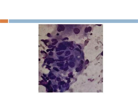 Special Stains In Cytology Pptx