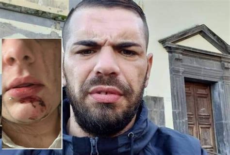 Picchia E Rapina Una Ragazza A Gragnano Condannato Federico Ingenito