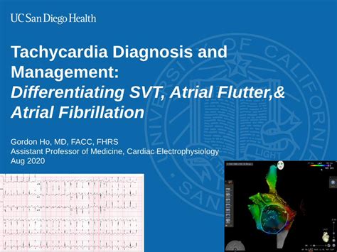 PDF Tachycardia Diagnosis And Management Differentiating SVT