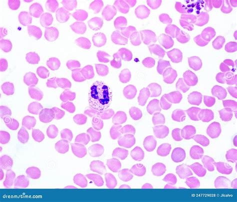 Wbc Toxic Granulation Images