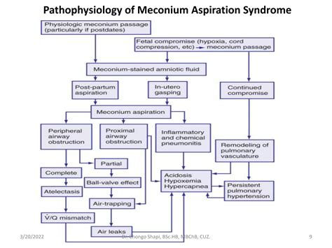 Meconium Aspiration Syndromepdf