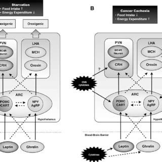 PDF Cancer Cachexia Pathophysiology And Management