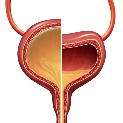 Overactive Bladder Symptoms Causes Diagnosis And Treatment