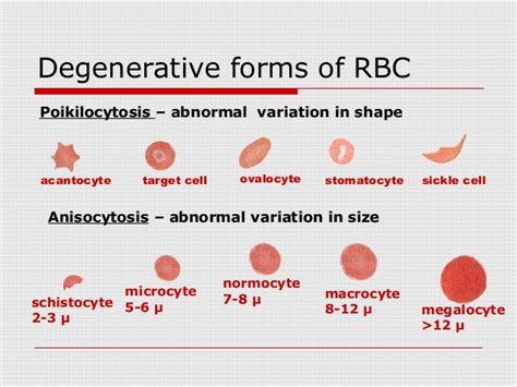 Poikilocytosis Definition Symptoms Causes Types Treatment