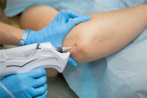 รูปภาพmicroinjection เลือกดูภาพถ่ายสต็อก เวกเตอร์ และวิดีโอ154 Adobe Stock