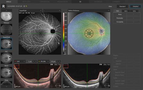 Iol Calculation Optopol Technology Ophthalmic Diagnostic Equipment