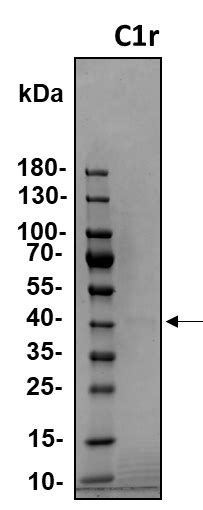 Recombinant Human Complement Component C1r Protein Cf 1807 Se 010 Randd