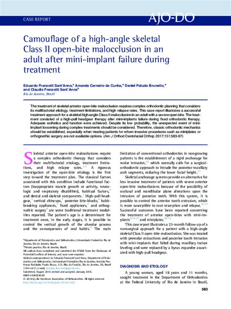Pdf Camouflage Of A High Angle Skeletal Class Ii Open Bite