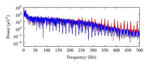 A Power Spectrum Of The Scalp Potential Of Figure 9a After Download Scientific Diagram