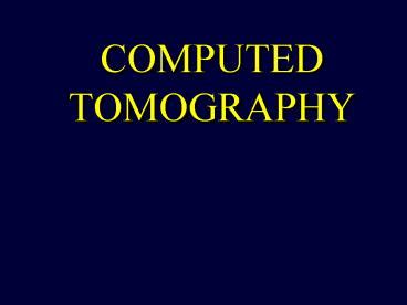COMPUTED TOMOGRAPHY Presentation Free To View