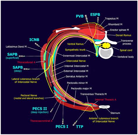 What Is Chest Esp At Sharon Cordero Blog