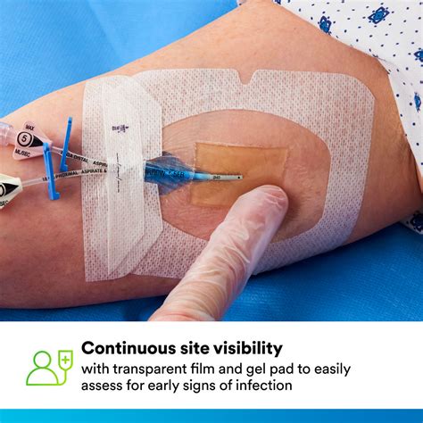 3m™ Tegaderm™ Chg Chlorhexidine Gluconate I V Securement Dressing 1658