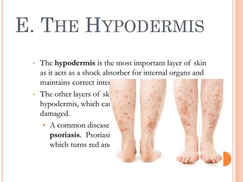 Ppt Integumentary System Powerpoint Presentation Free Download Id