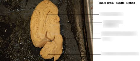 Sheep Brain Sagittal View Diagram Quizlet Sheep Brain Sagittal View Diagram Quizlet