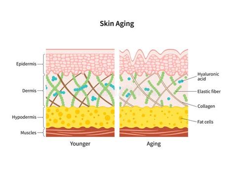 Skin Aging Comparison Young Aged Skin Vector Illustration Stock Vector