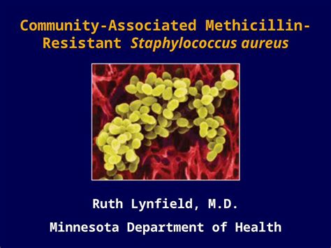 Ppt Community Associated Methicillin Resistant Staphylococcus Aureus Ruth Lynfield Md