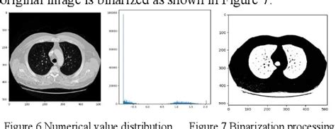 Figure 1 From Lung Nodule Detection Method Based On Improved Yolov4