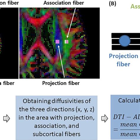 Calculation Of The Dti‐alps Index A Place The Region Of Interests In