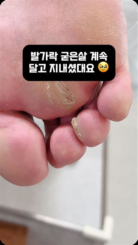 가평 발관리샵 리아풋케어 발톱무좀관리•굳은살제거•패디플래닝 👣 발각질 그냥 겉만 밀어내는 걸로는 부족해요 표면이 잠시 매끈해 보여도 속은 여전히 딱딱하고 거칠