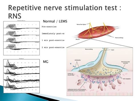Ppt Eeg Brain For Medical Investigation And Management Powerpoint Presentation Id 2972430