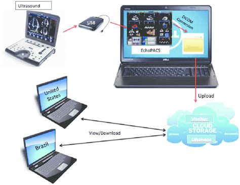 Flow Of Dicom Echocardiograms From Echo Machine To Usb To Echopacs Download Scientific Diagram