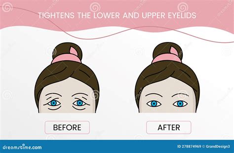 Tightens The Lower And Upper Eyelid Line Icon In Vector Illustration