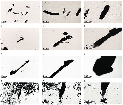 Transmission Electron Microscopy Of V Parahaemolyticus And A