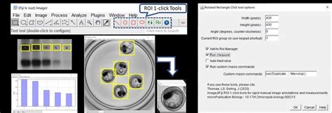 Rapid Annotation Of Standard Shapes With The Roi 1 Click Tools For