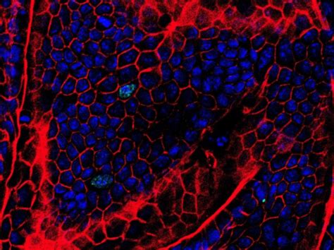 Biomedical Engineering Bme