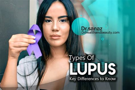 Types Of Lopus Key Differences To Know Drhealthandbeauty