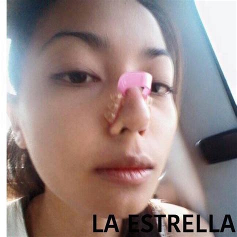 Super V Shape 2อาทิตย์เริ่มเปลี่ยนแปลง