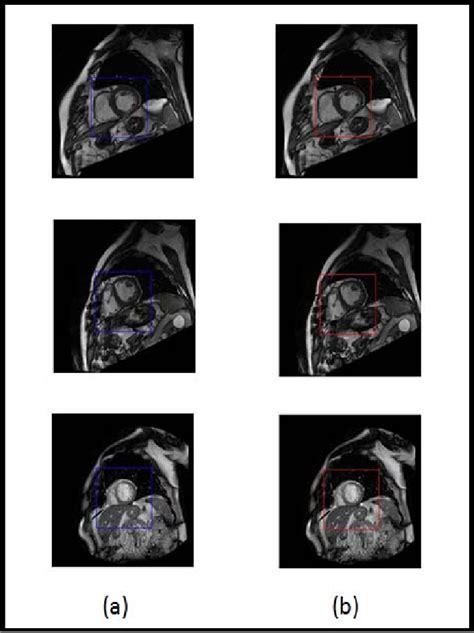 shows results of the proposed algorithm a and the results of