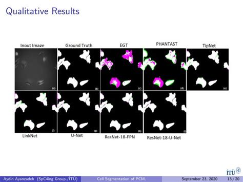 Deep Learning Based Segmentation Pipeline For Label Free Phase Contrast